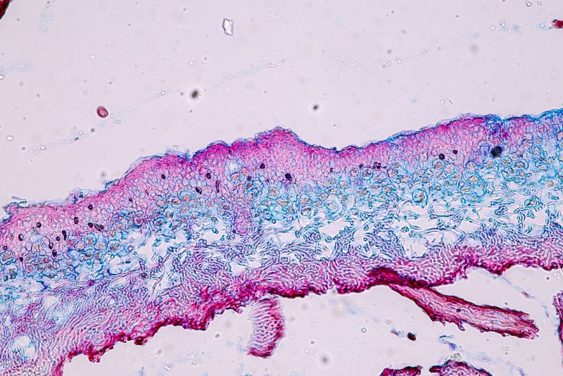 Lichen Thallus Cross Section