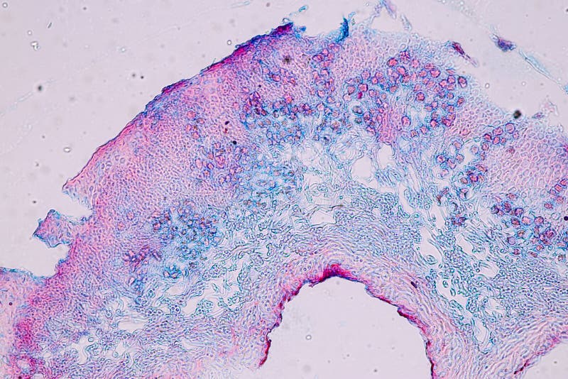 Lichen, Hyphae and Symbiotic Algae Under the Microscope for Education ...