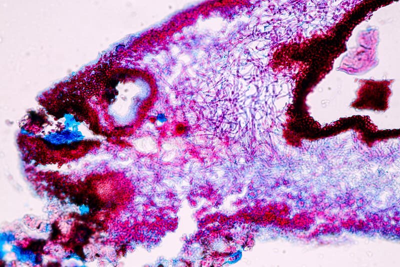 Lichen, Hyphae and Symbiotic Algae Under the Microscope for Education ...