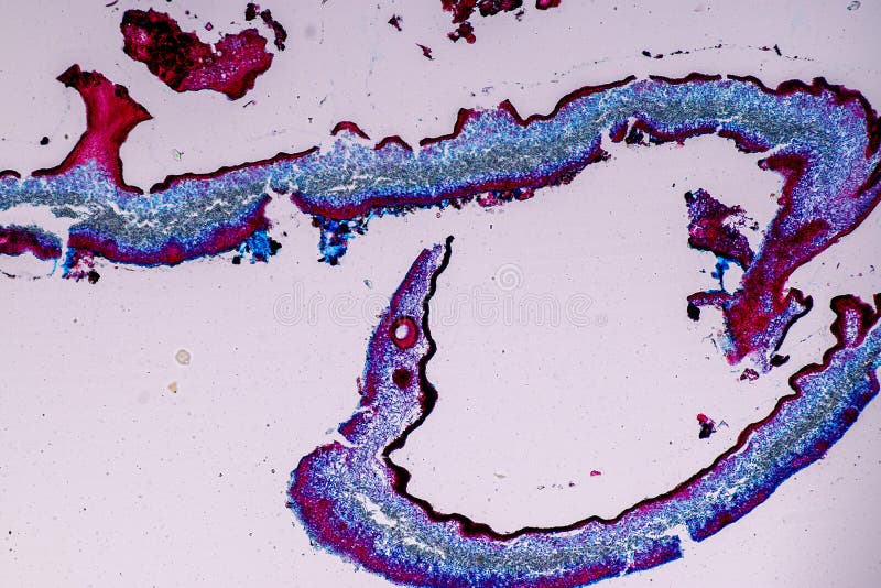 Lichen, Hyphae and Symbiotic Algae Under the Microscope for Education ...