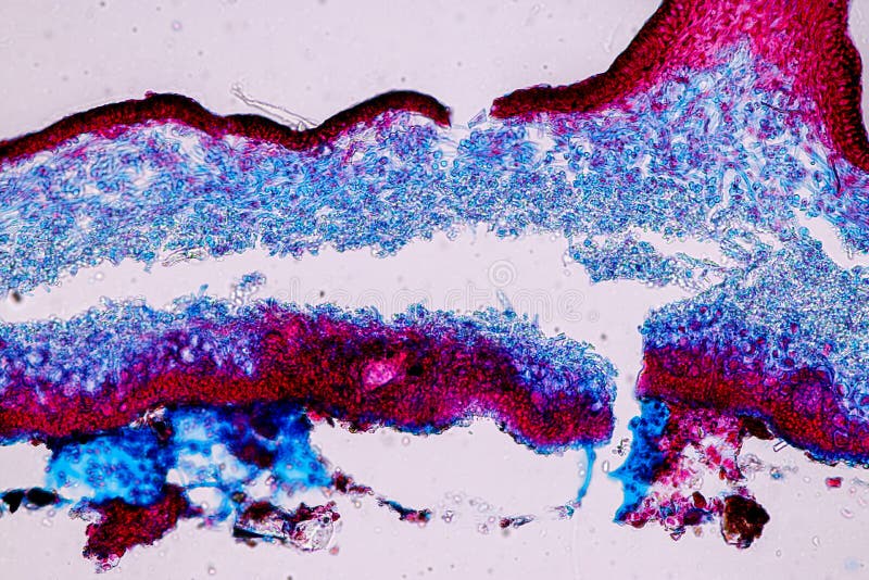Lichen, Hyphae and Symbiotic Algae Under the Microscope for Education ...