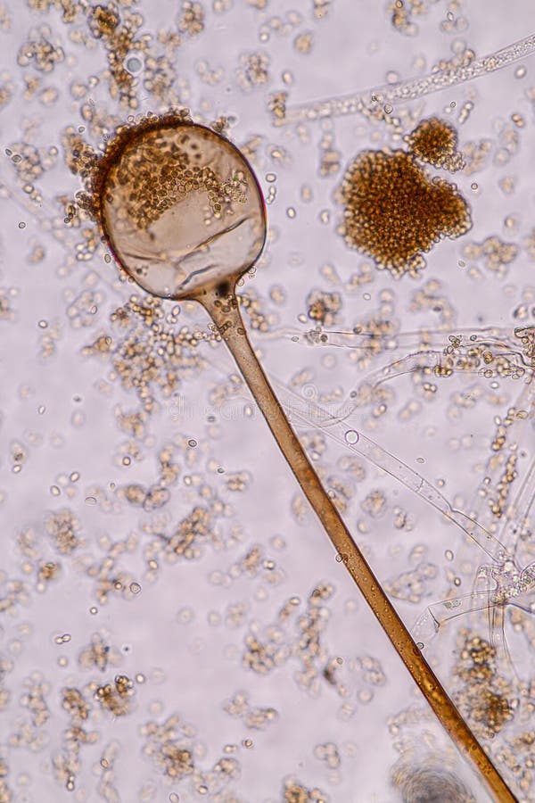 Rhizopus Under Compound Microscope