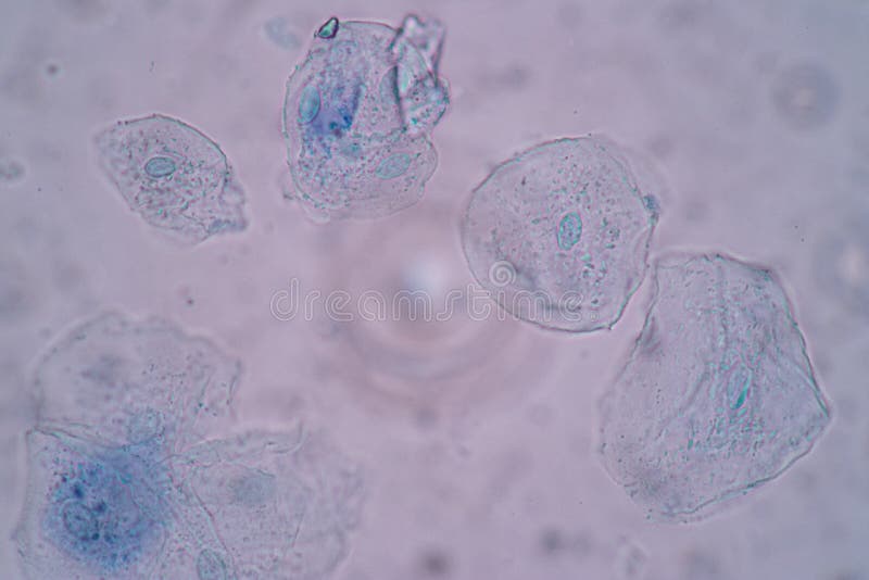 Human Cheek Cells Under A Microscope