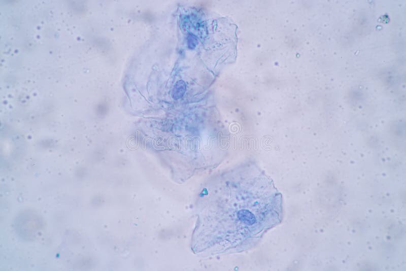 Cheek Cells 400x Stained