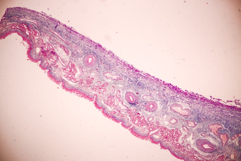 Characteristics Tissue of Olfactory Epithelium Human Under the ...