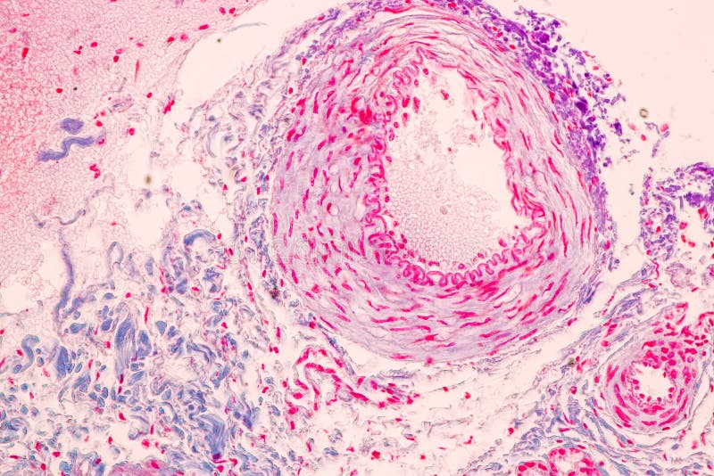 Characteristics Tissue of Olfactory Epithelium Human Under the ...