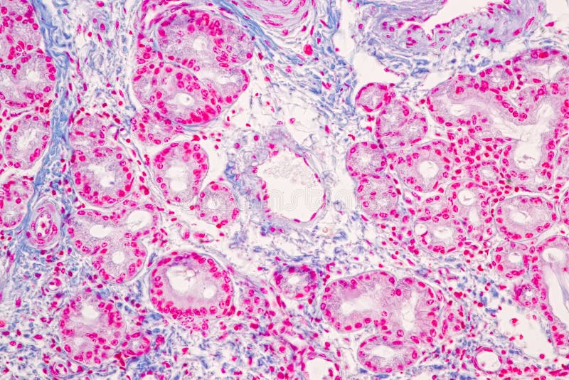 Characteristics Tissue of Olfactory Epithelium Human Under the ...