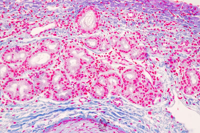 Characteristics Tissue of Olfactory Epithelium Human Under the ...