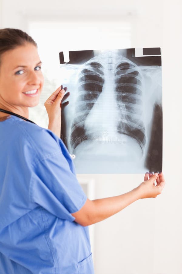 Charming Doctor Smiling and Holding a X-ray Stock Image - Image of ...
