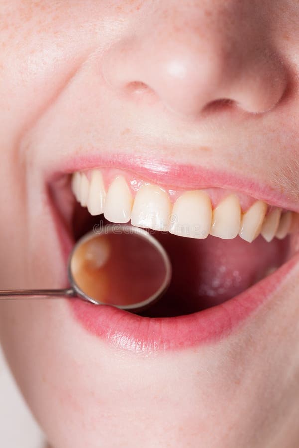 Check the teeth stock photo. Image of pain, dentist, human - 82548684