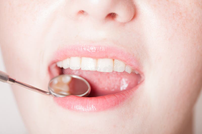 Check the teeth stock photo. Image of patient, dentist - 82548684