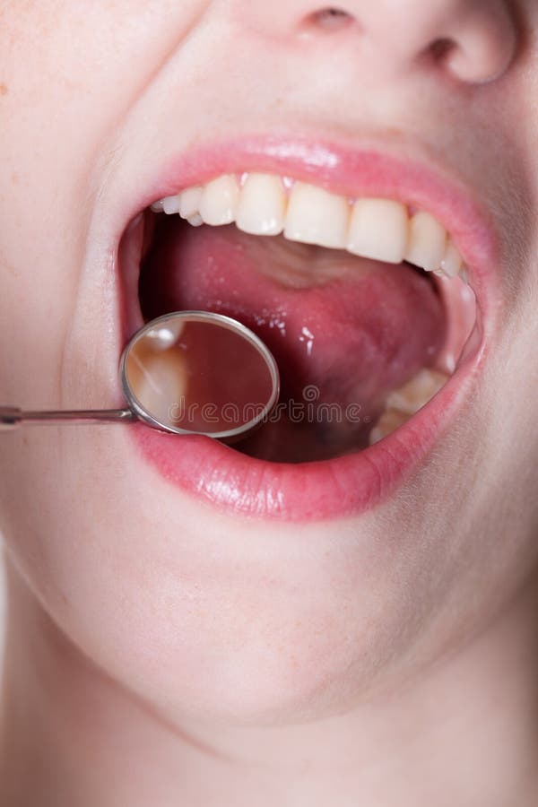 Check the teeth stock photo. Image of patient, dentist - 82548684