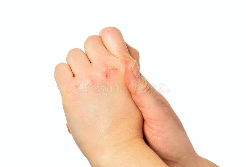 Checking the hand stock photo. Image of condition, examining - 123493560