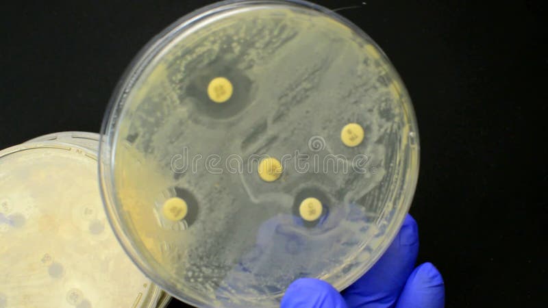 Checking Results for Antimicrobial Resistance Disk Diffusion Assay ...