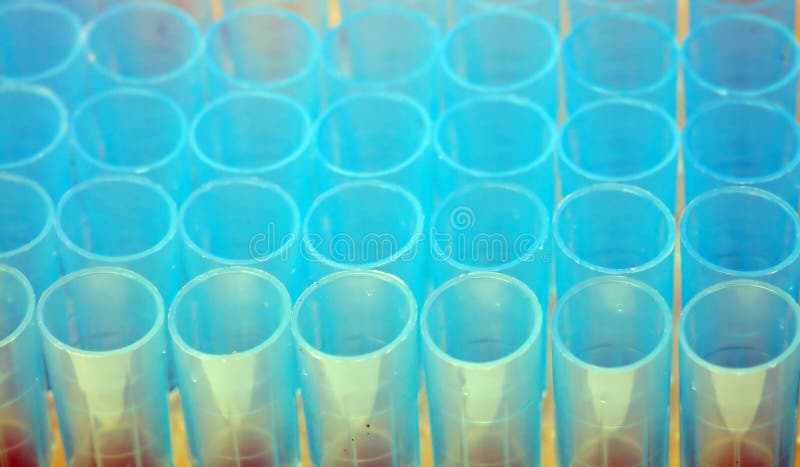 Chemical Bottles for Testing Stock Photo - Image of doctor, chemical ...
