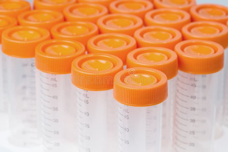 Plastic Tubes With Orange Caps Stock Photo - Image of laboratory ...