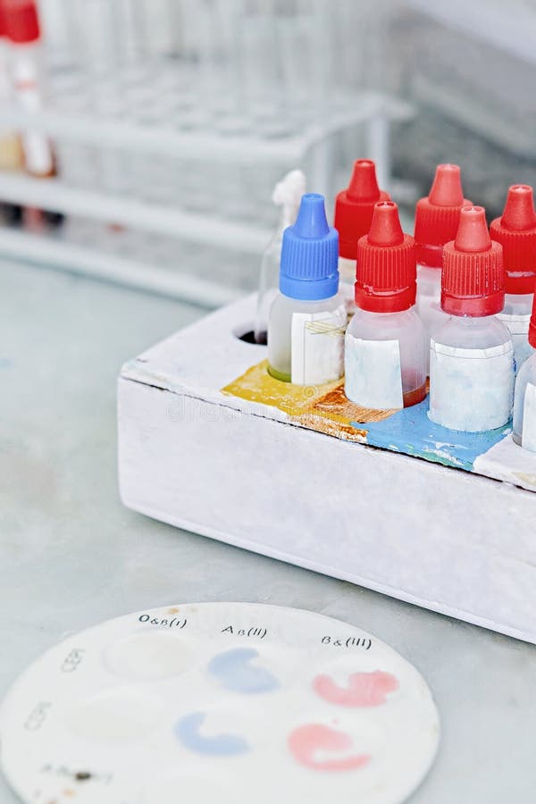 Hospital, Chemistry Lab, Blood Sample Cup Stock Image - Image of blood ...