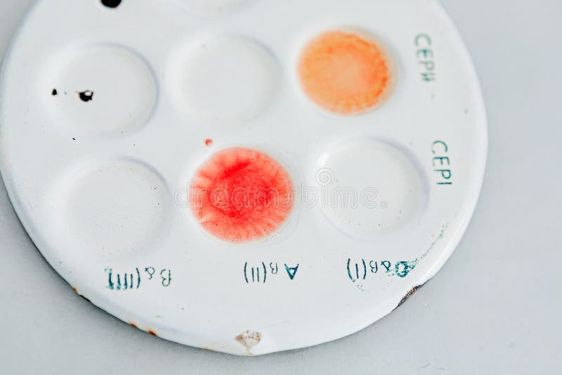 Hospital, Chemistry Lab, Blood Sample Cup Stock Image - Image of ...