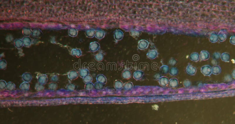 Cherry Blossom in Darkfield Stock Footage - Video of microscopy ...