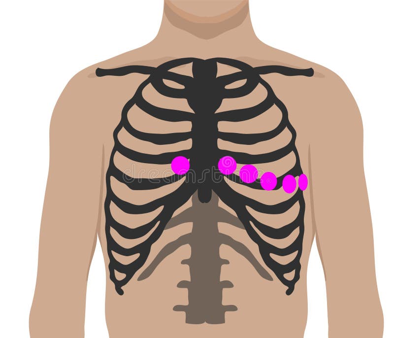 ECG chest leads stock vector. Illustration of electrocardiogram - 12861426