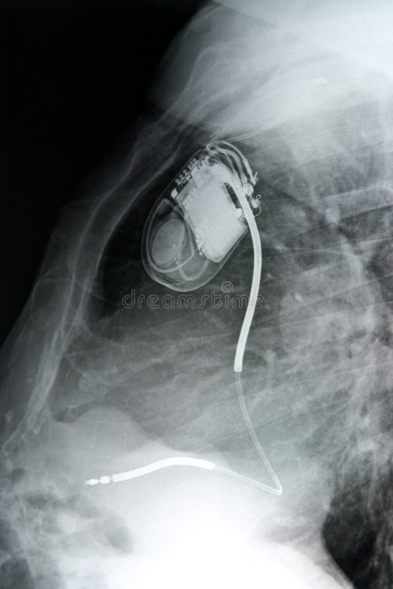 1,066 Parts Chest Stock Photos - Free & Royalty-Free Stock Photos from ...