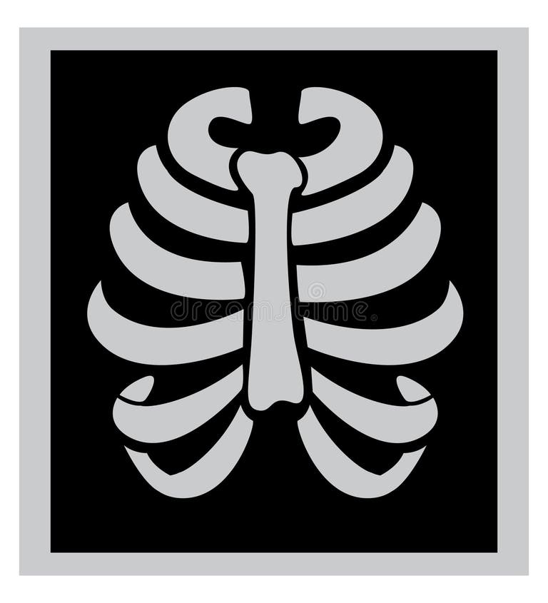 Cartoon Chest Ray Stock Illustrations – 802 Cartoon Chest Ray Stock ...