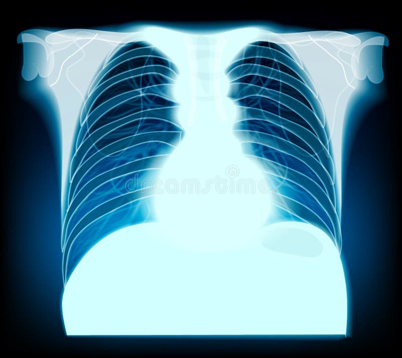 Chest x-ray. stock illustration. Illustration of organ - 34924441