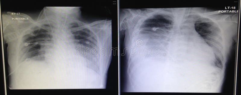 Carina Right Heart Stock Photos - Free & Royalty-Free Stock Photos from ...