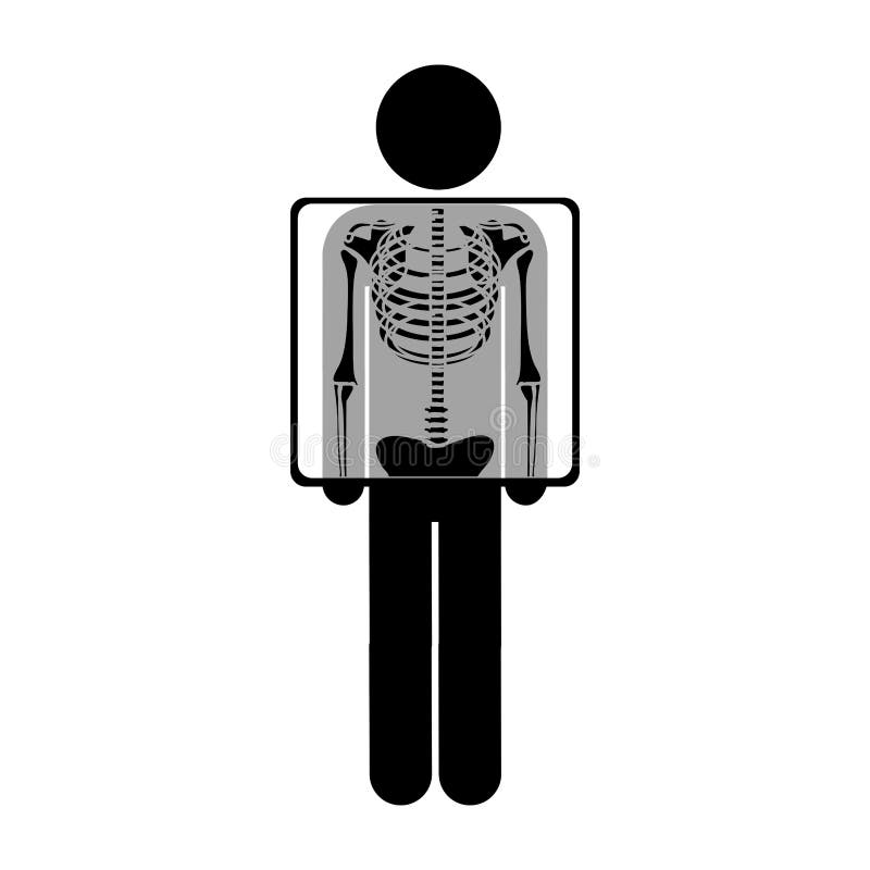 Chest x-ray icon image stock vector. Illustration of doctor - 79554793