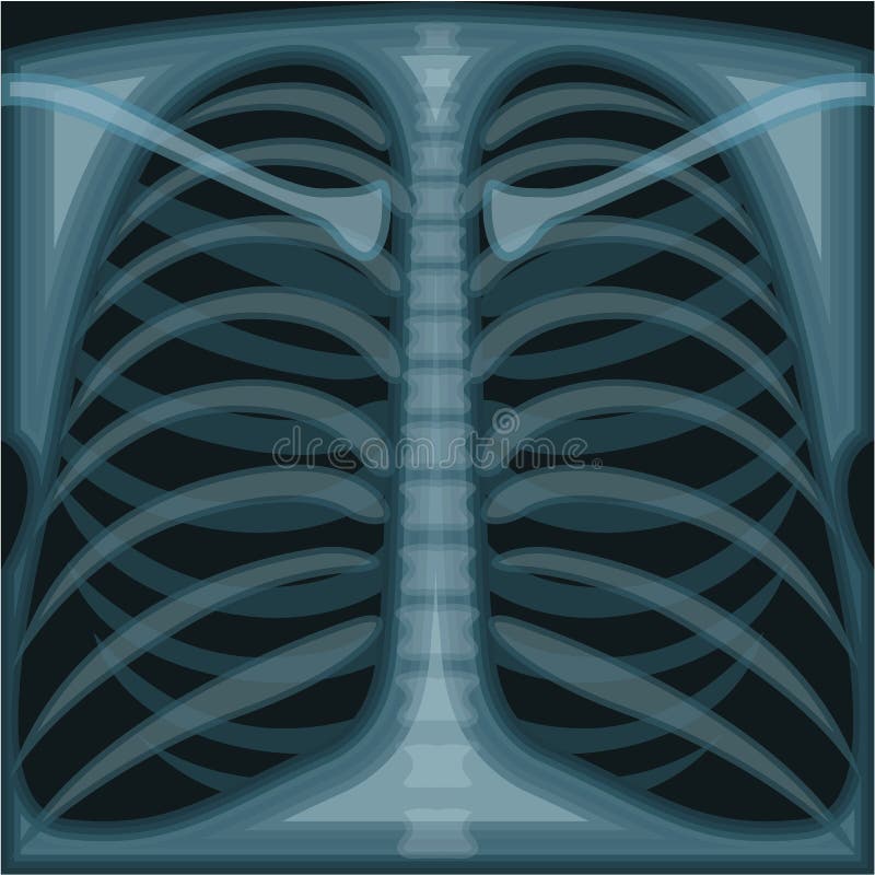 Chest X-ray stock vector. Illustration of breathe, clip - 41538023