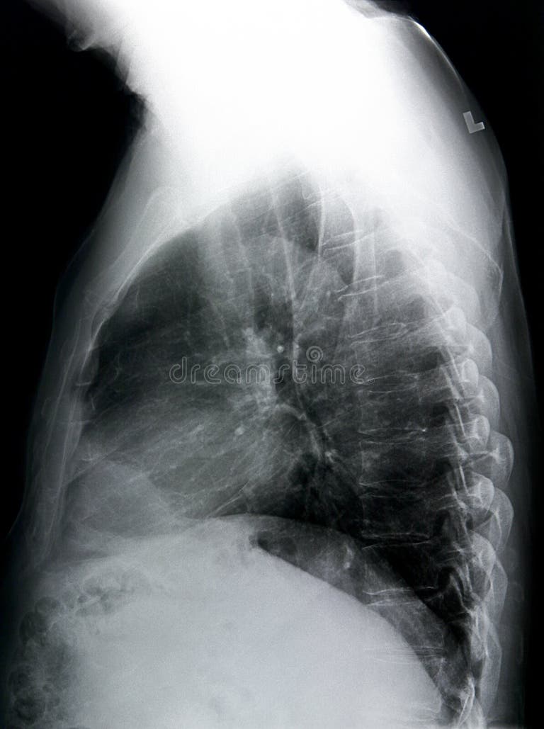 1,066 Parts Chest Stock Photos - Free & Royalty-Free Stock Photos from ...