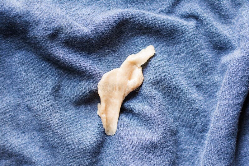 Chewing Gum Sticky on Clothes. Stock Image - Image of foot, clothes ...