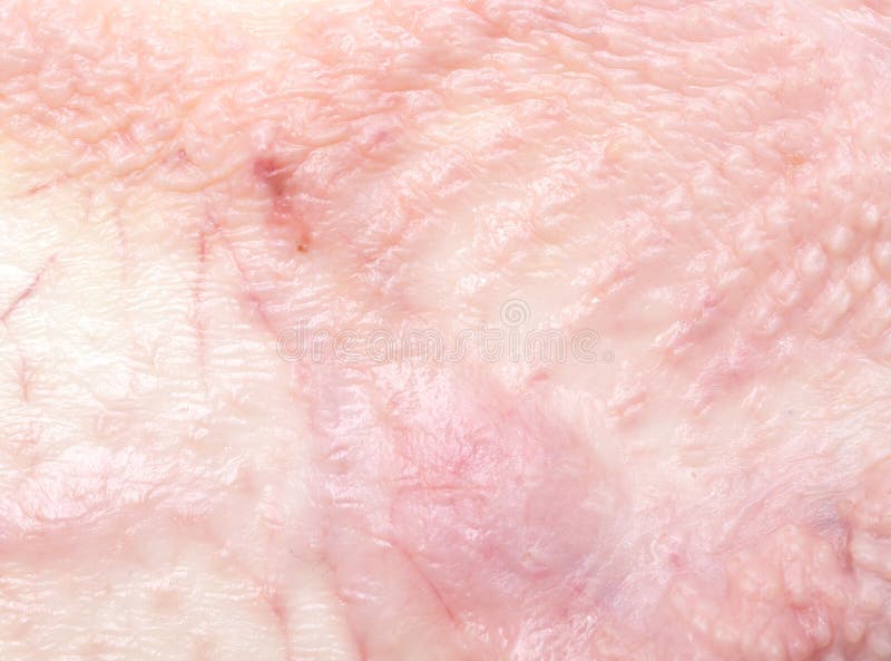 869 Chicken Skin Texture Background Stock Photos - Free & Royalty-Free ...