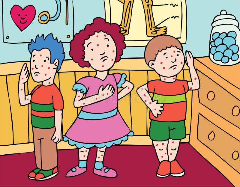 Chickenpox Stock Illustrations – 1,041 Chickenpox Stock Illustrations ...