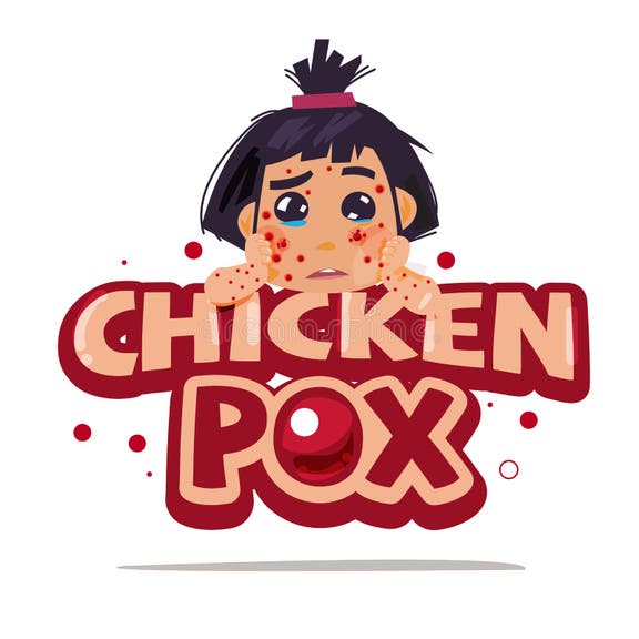 Chicken Pox Illustration Stock Illustrations – 461 Chicken Pox ...