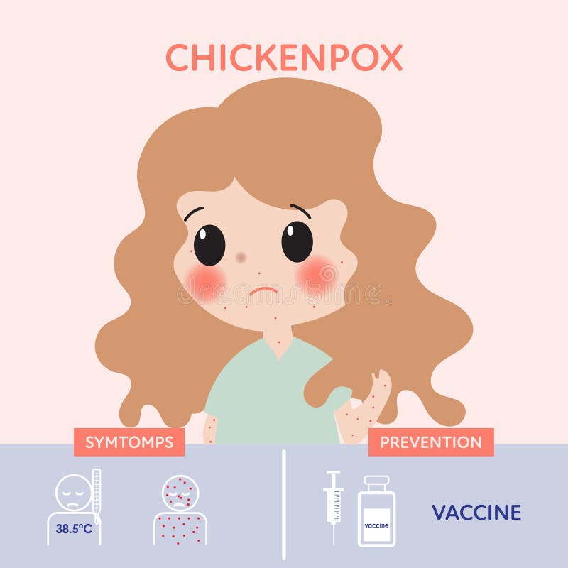 Chickenpox with Symptoms and the Prevention in Children Stock Vector ...