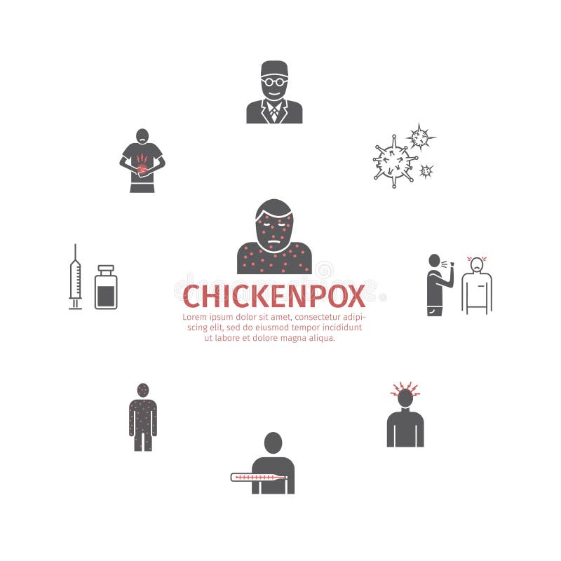 Chickenpox Infographic Stock Illustrations – 48 Chickenpox Infographic ...