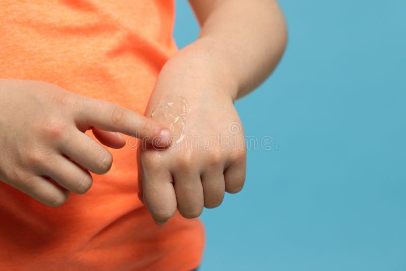 Child Applying Ointment Onto Hand Against Light Blue Background ...