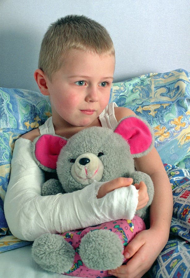 Child with Broken Arm in Plaster Stock Image - Image of bandage, hand ...