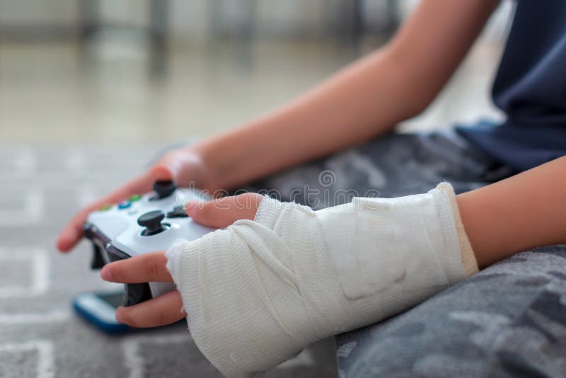 Child with Broken Arm Using Video Game Controller Stock Image - Image ...