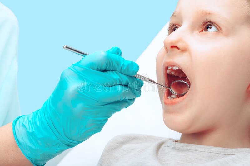 A Child at the Dentist`s Examination Close-up Stock Image - Image of ...