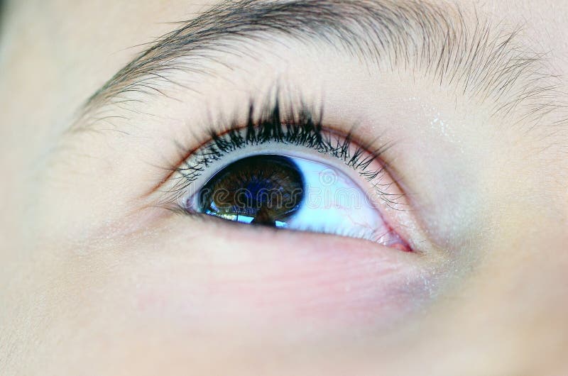 Child eye stock image. Image of blood, closeup, eyehole - 77368787