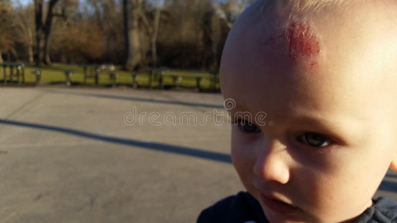 Child with Head Injury stock image. Image of care, good - 51510103