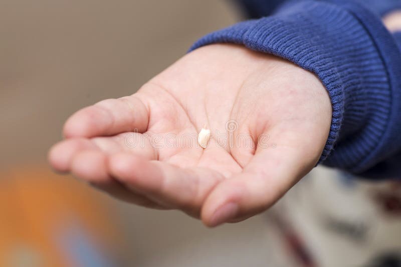 The Child Holds a Fallen Tooth on the Palm of His Hand. Milk Tooth on ...