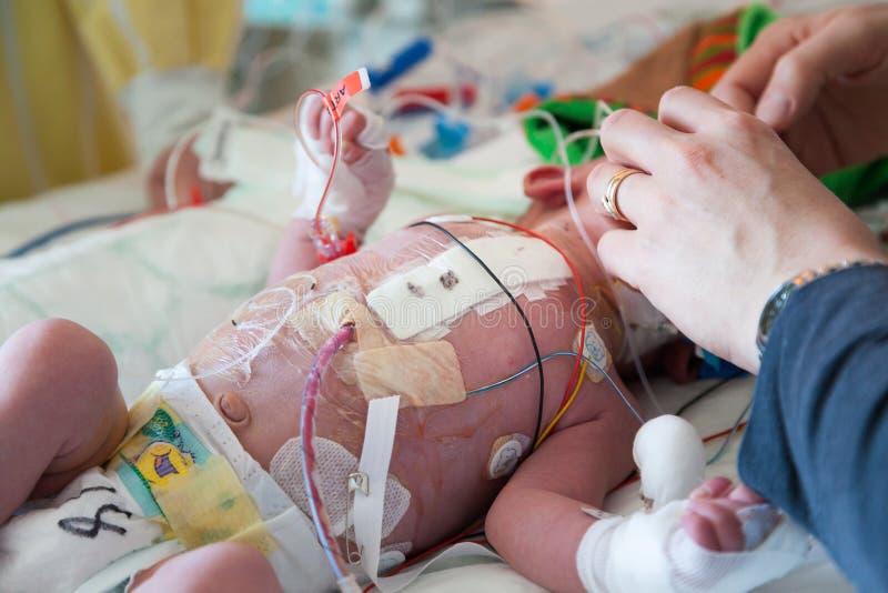 Child intensive care stock photo. Image of intensive - 64437998