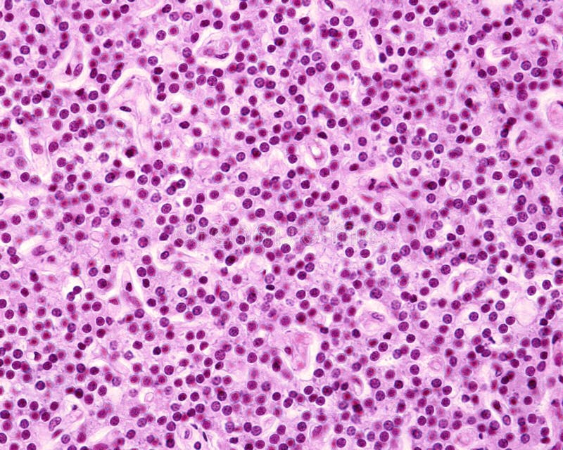 Child parathyroid gland stock image. Image of micrograph - 236433065