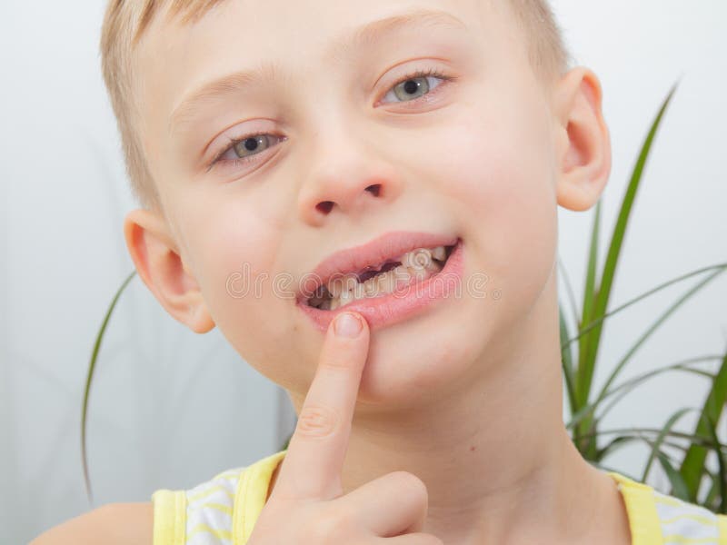 Child Points His Finger at the Hole in His Teeth after Pulling Out Baby ...