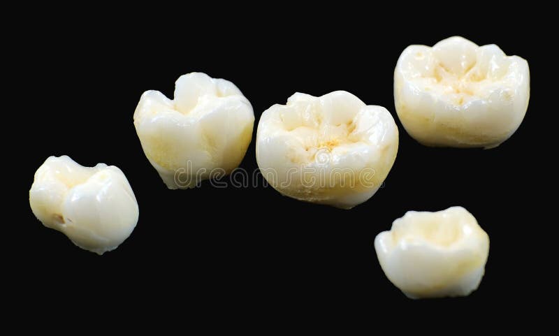 Child S Fallen Milk Primary Teeth Isolated on Black Close Up Stock ...