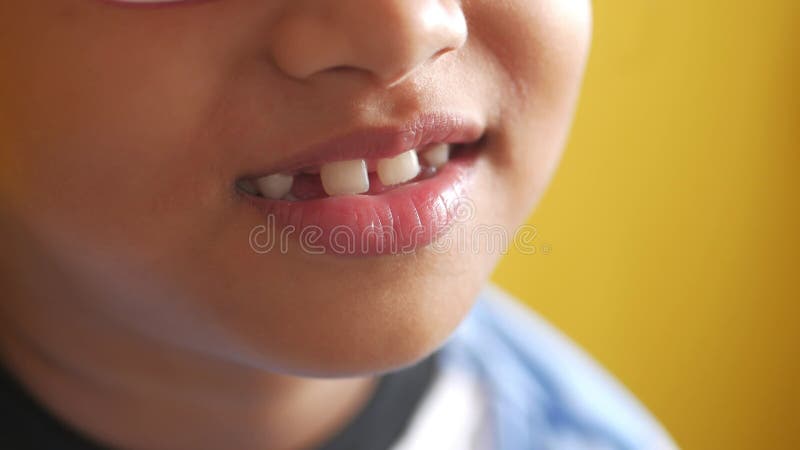 Child Smiling with Teeth Missing Stock Video - Video of growth ...