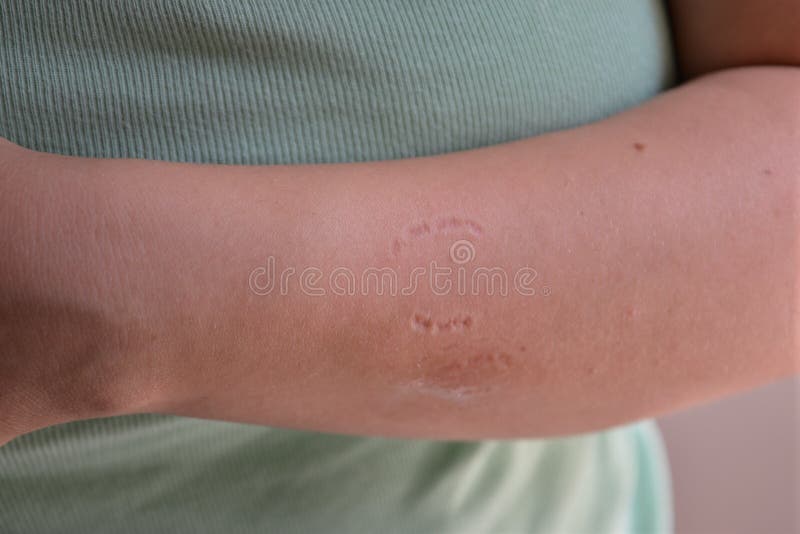 Children bite stock photo. Image of closeup, kids, fresh - 32103212